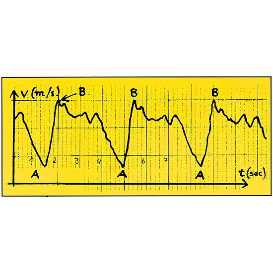 Swimsportec "Speedometer" Swim Timing System buy at Sport-Thieme.com